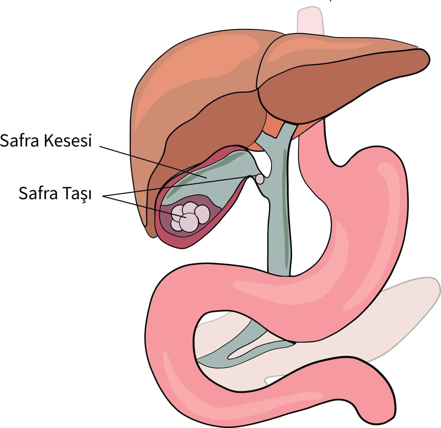 Safra Kesesi Ameliyatı – Prof. Dr. Halil Coşkun